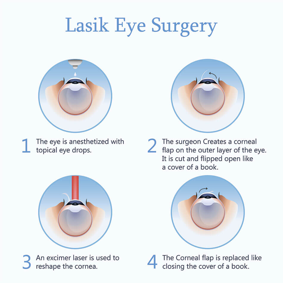 Tips to Improve Your Eyesight and See Without Glasses | Perfectlens Canada Tips to Improve Your Eyesight and See Without Glasses | Perfectlens Canada